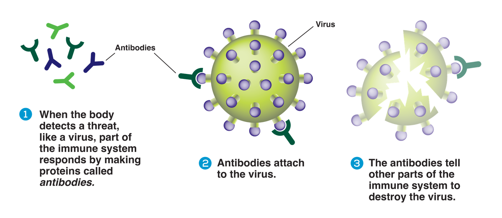 GAMMAKED™ PI Education: Diagnosis, Symptoms & Treatments